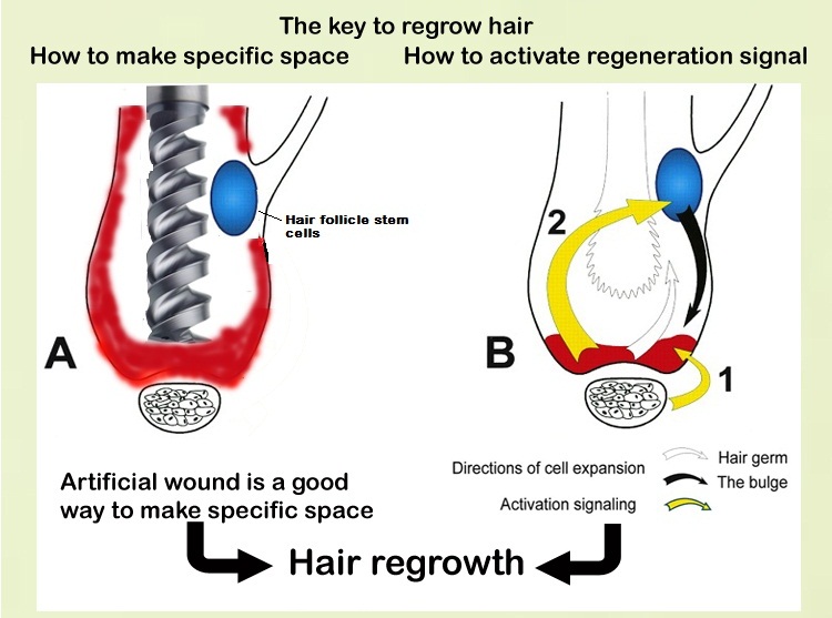 WanBinCell Hair-Growth-Promoting Solution | Indiegogo