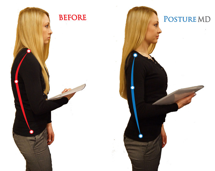 Posture MD - Confidence Correction through Posture | Indiegogo