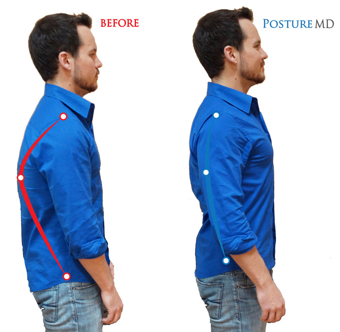 Posture MD - Confidence Correction through Posture | Indiegogo