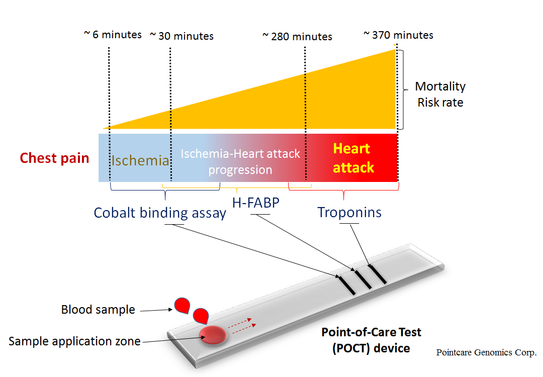 Saving Life through Early Detection of Heart Attack | Indiegogo