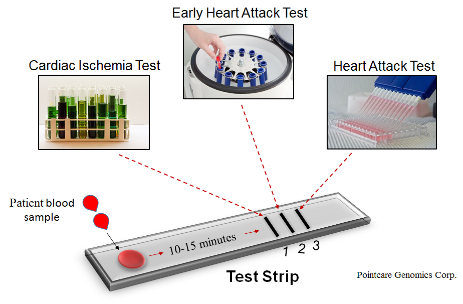 Saving Life through Early Detection of Heart Attack | Indiegogo